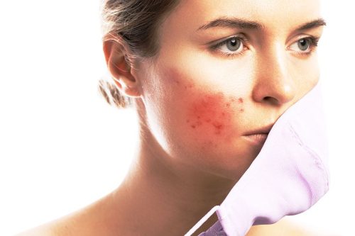 Is Pen Ink Bad for Your Skin? - Writing on Your Skin With Pen